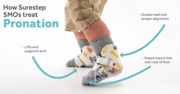 Why Do Surestep SMO Braces Look Backwards? | Surestep