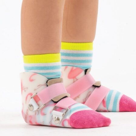 Pigeon Toes - What, Why & When Kids Need Treatment | Surestep